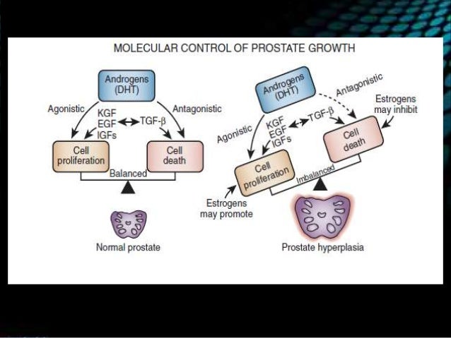 Etiology and pathophysiology of bph