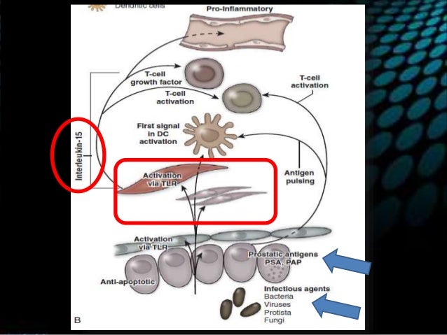 Etiology and pathophysiology of bph