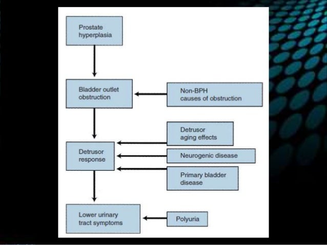 Etiology and pathophysiology of bph