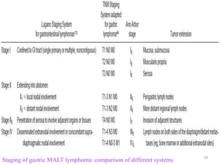 Etiology & Molecular Genetics of MALT Lymphoma | PPTX