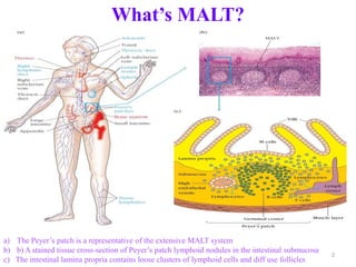 Etiology & Molecular Genetics of MALT Lymphoma | PPTX