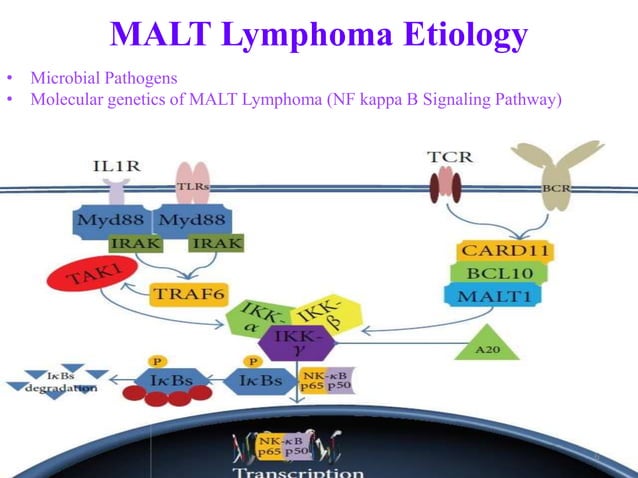 Etiology & Molecular Genetics of MALT Lymphoma | PPT