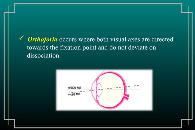Etiology of heterophoria and heterotropia | PPT