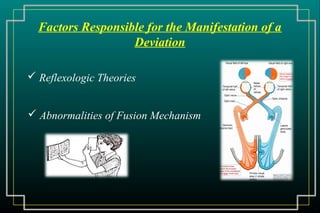 Etiology of heterophoria and heterotropia | PPT