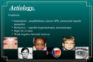 Etiology of heterophoria and heterotropia | PPT