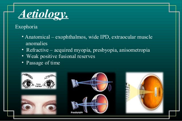 Etiology of heterophoria and heterotropia