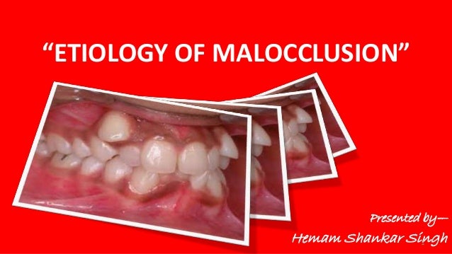 Etiology of malocclusion