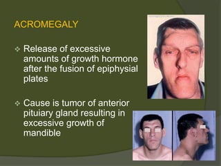 Etiology of malocclusion | PPTX