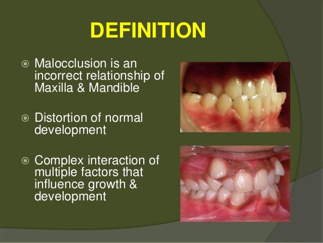 Etiology of malocclusion