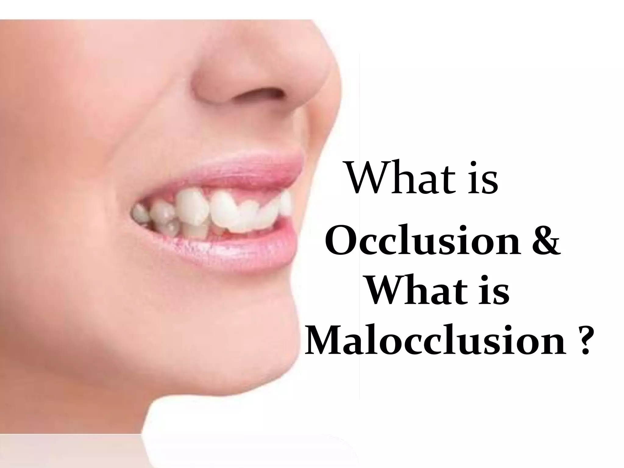Etiology of malocclusion | PPTX