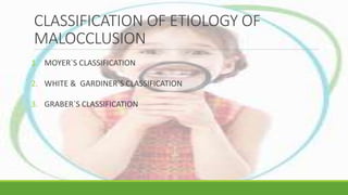 Etiology of malocclusion | PPTX