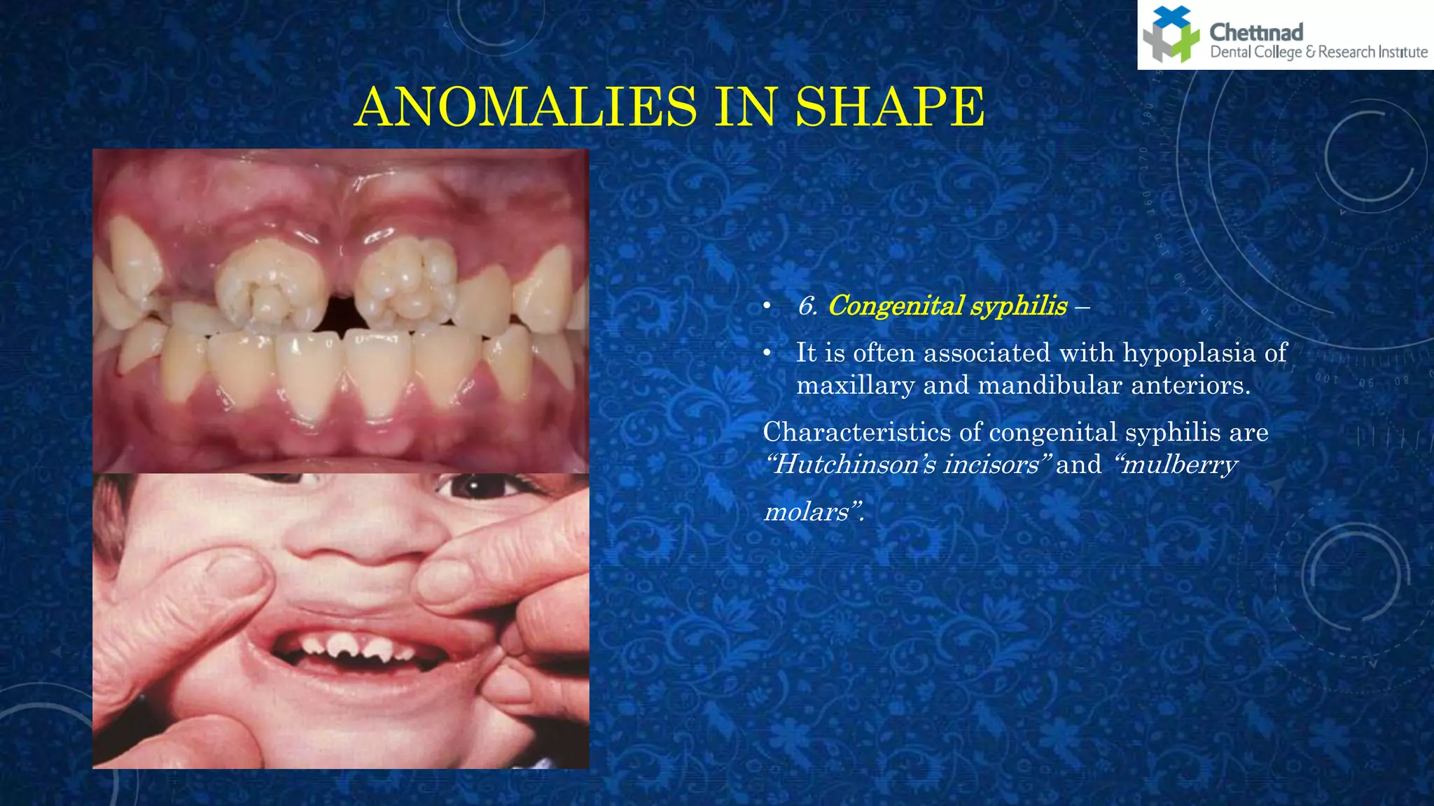 Etiology of malocclusion- IV BDS | PPTX