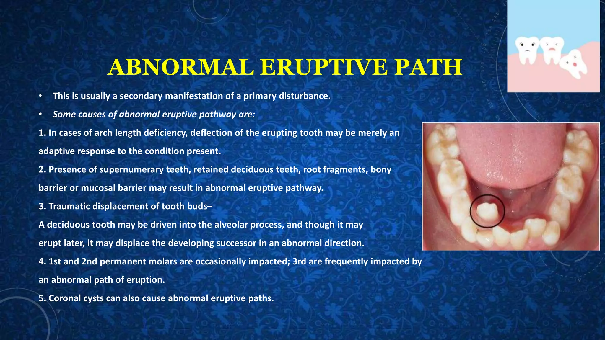 Etiology of malocclusion- IV BDS | PPTX