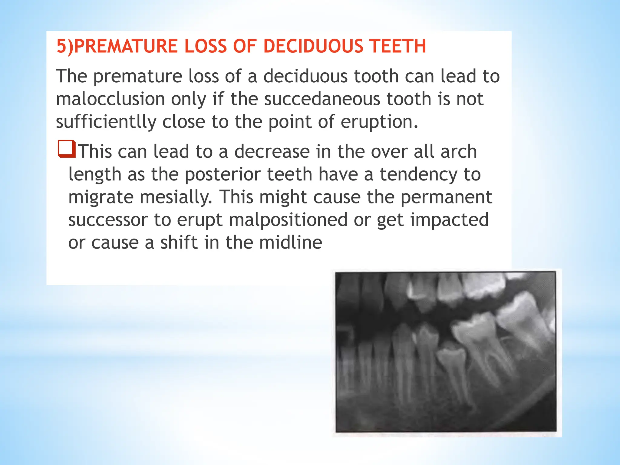 Etiology of malocclusion.pptx