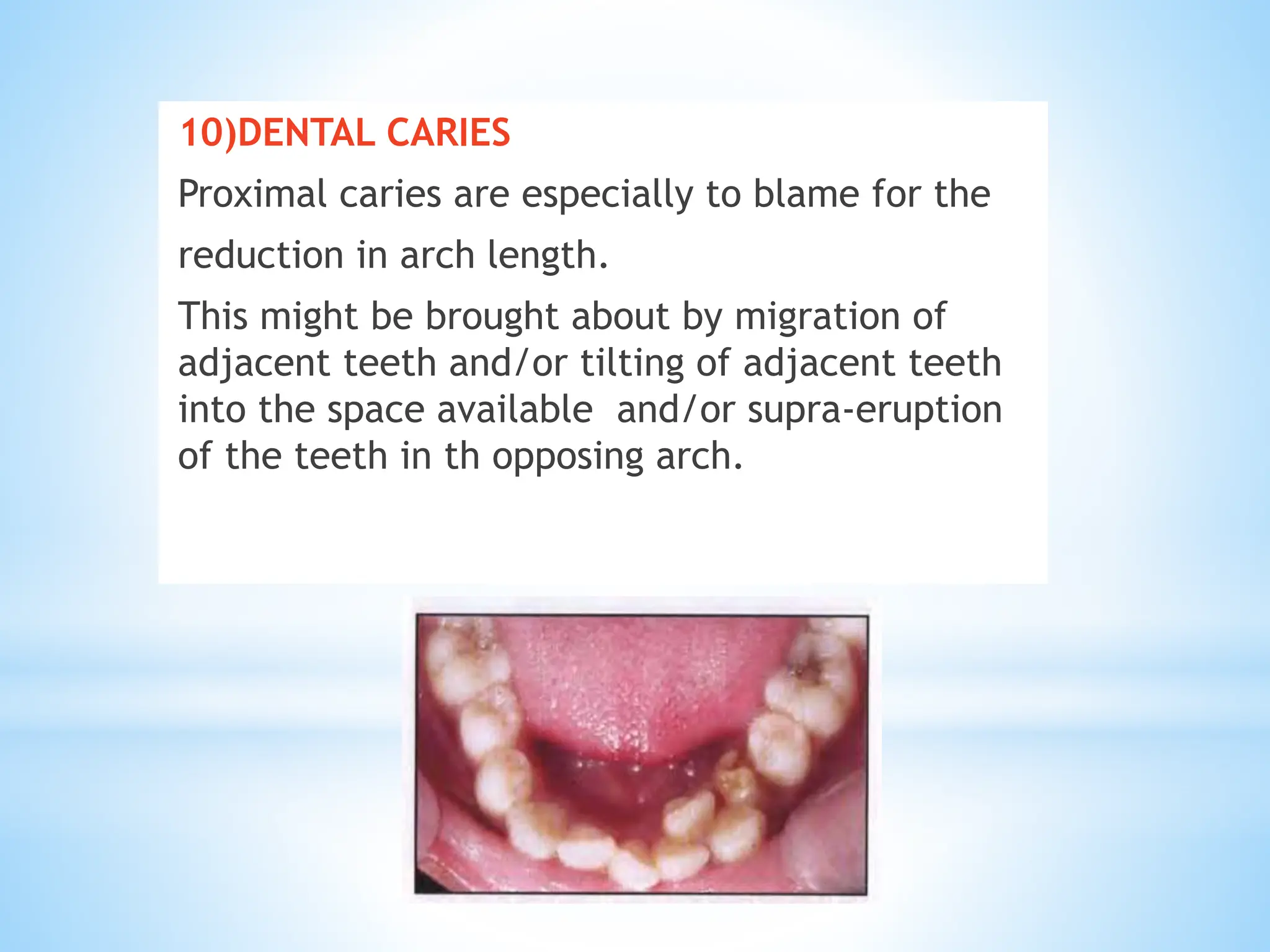Etiology of malocclusion.pptx