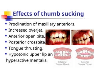 Etiology of malocclusion in orthodontics.ppt