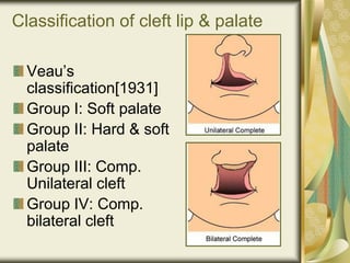 Etiology of malocclusion general factors | PPT