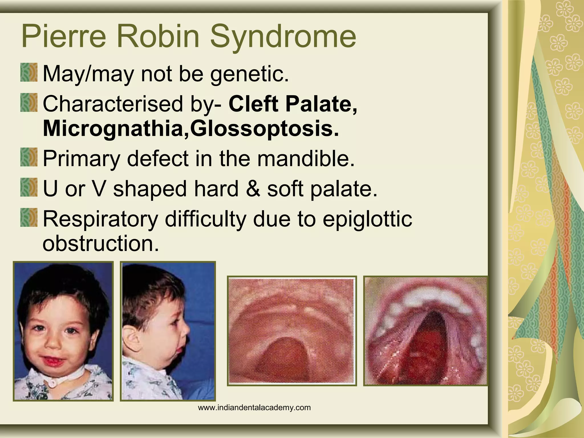 Etiology of malocclusion general factors