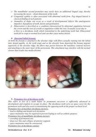 etiology of malocclusion for general practitioners.docx