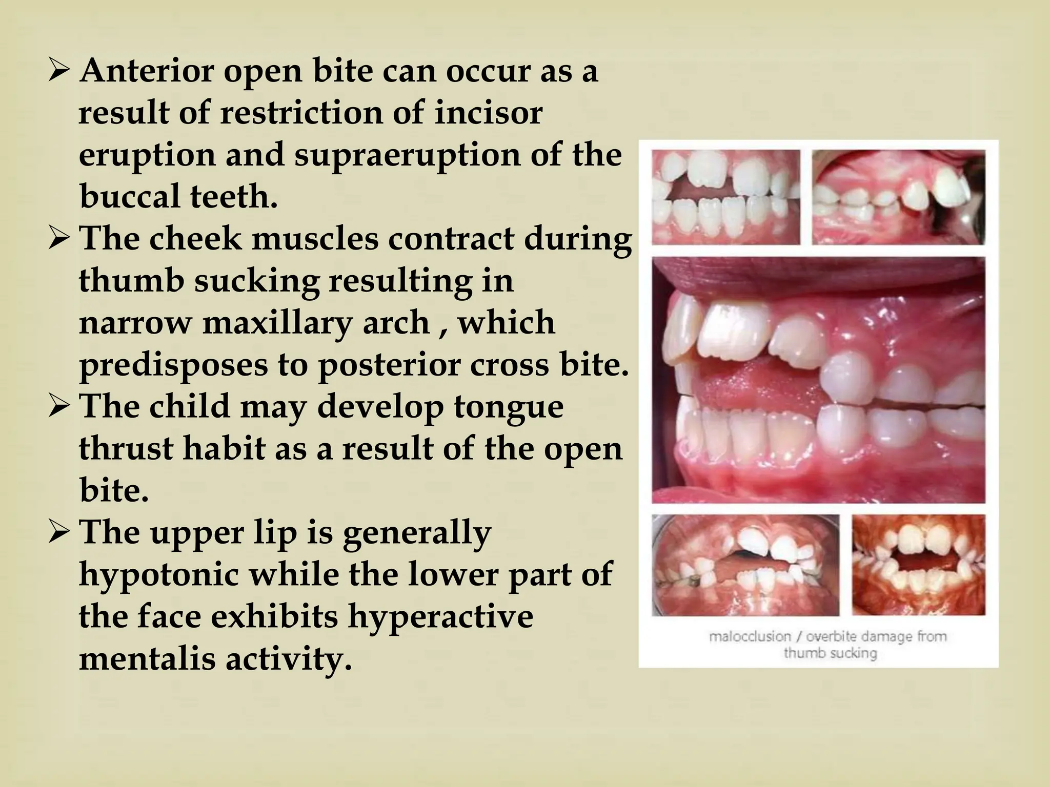 Etiology Of Malocclusion Part1.pptx | Pregnancy | Reproductive Health