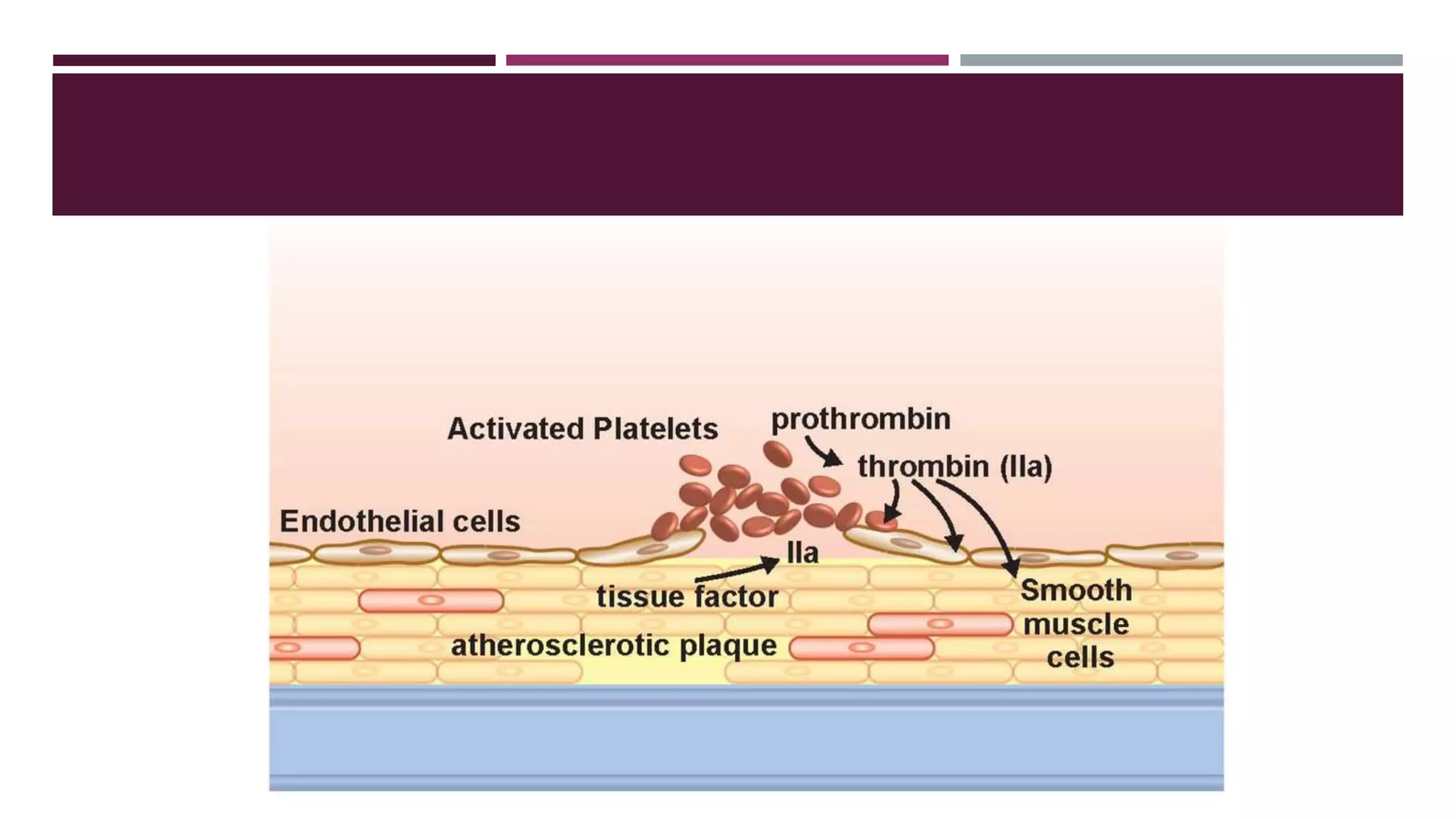 Etiology, pathogenesis & Morphology of thrombosis.pptx | Heart and ...