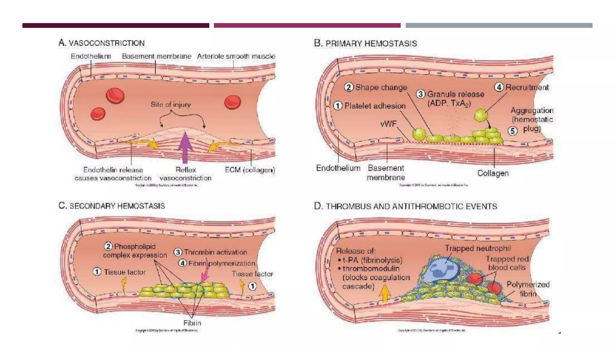Etiology, pathogenesis & Morphology of thrombosis.pptx