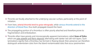 Etiology, pathogenesis & Morphology of thrombosis.pptx