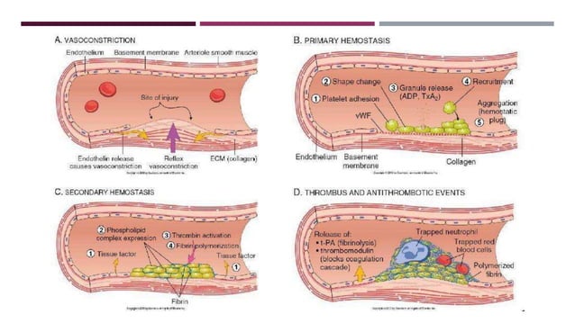 Etiology, pathogenesis & Morphology of thrombosis.pptx | Heart and ...