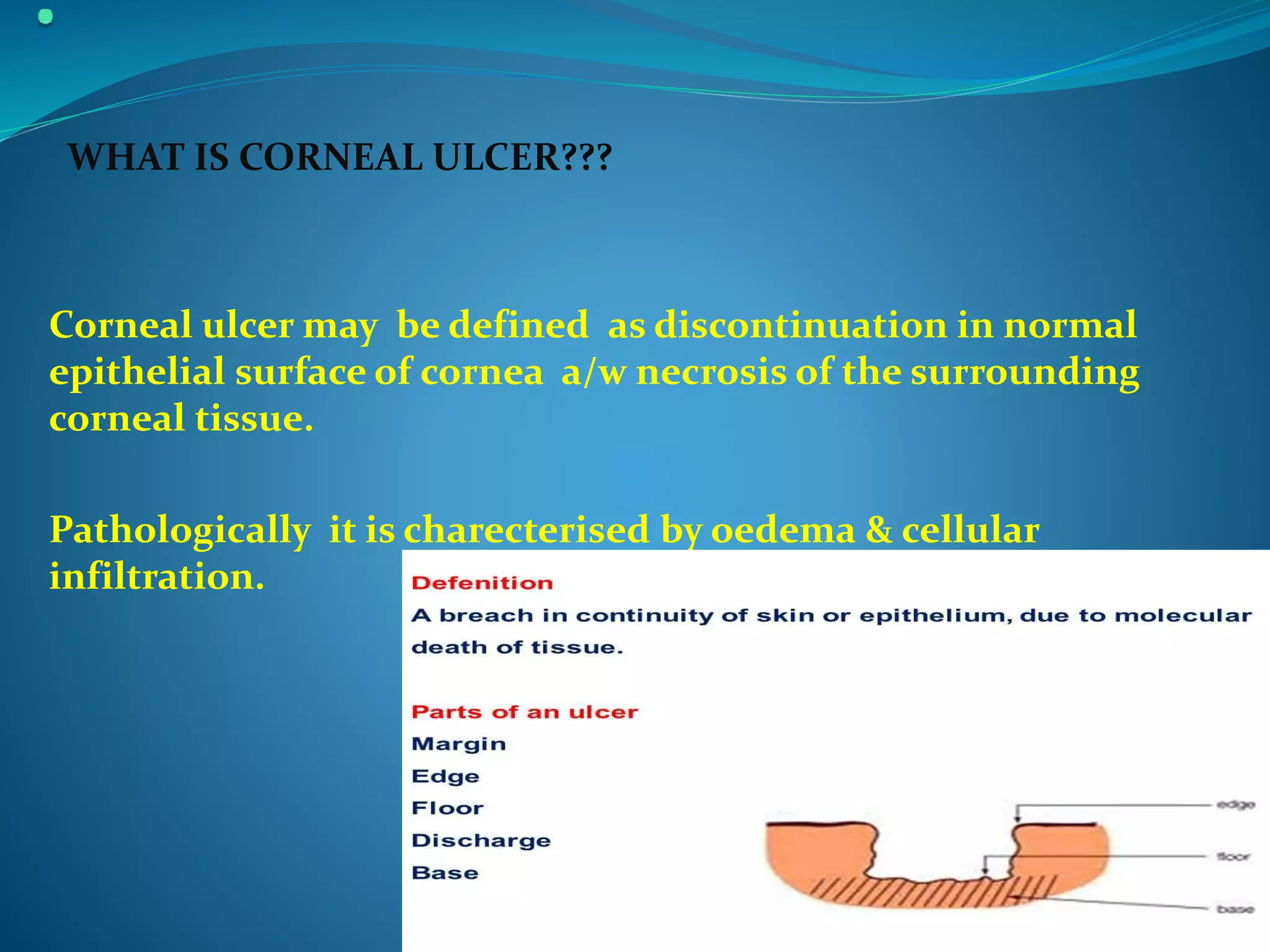 ETIOLOGY, PATHOLOGY AND PATHOGENESIS OF CORNEAL ULCER | PPTX