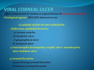 Dendritic Corneal Ulcer