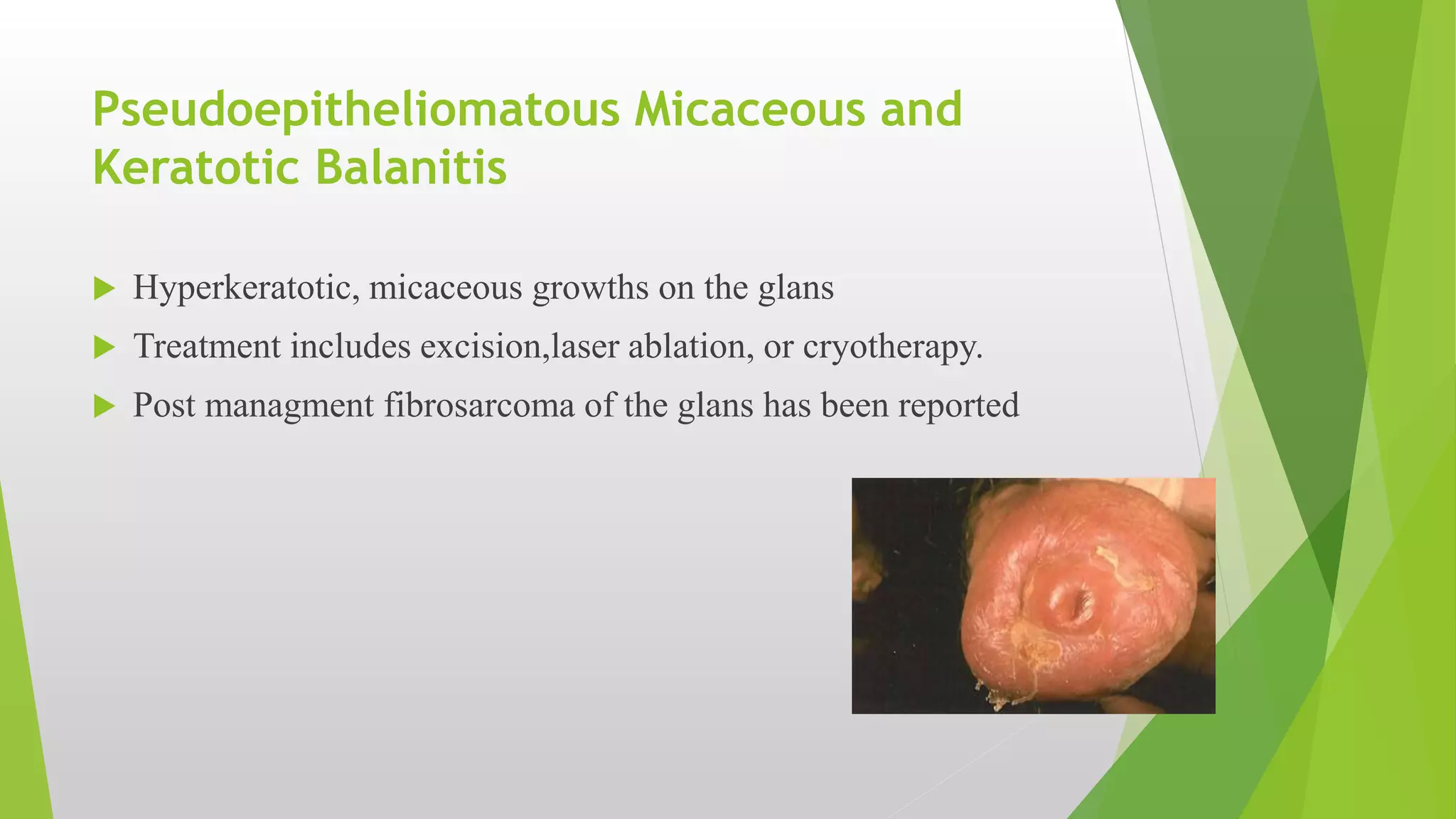 ETIOPATHOGENESIS AND STAGING OF CA PENIS (1).pptx