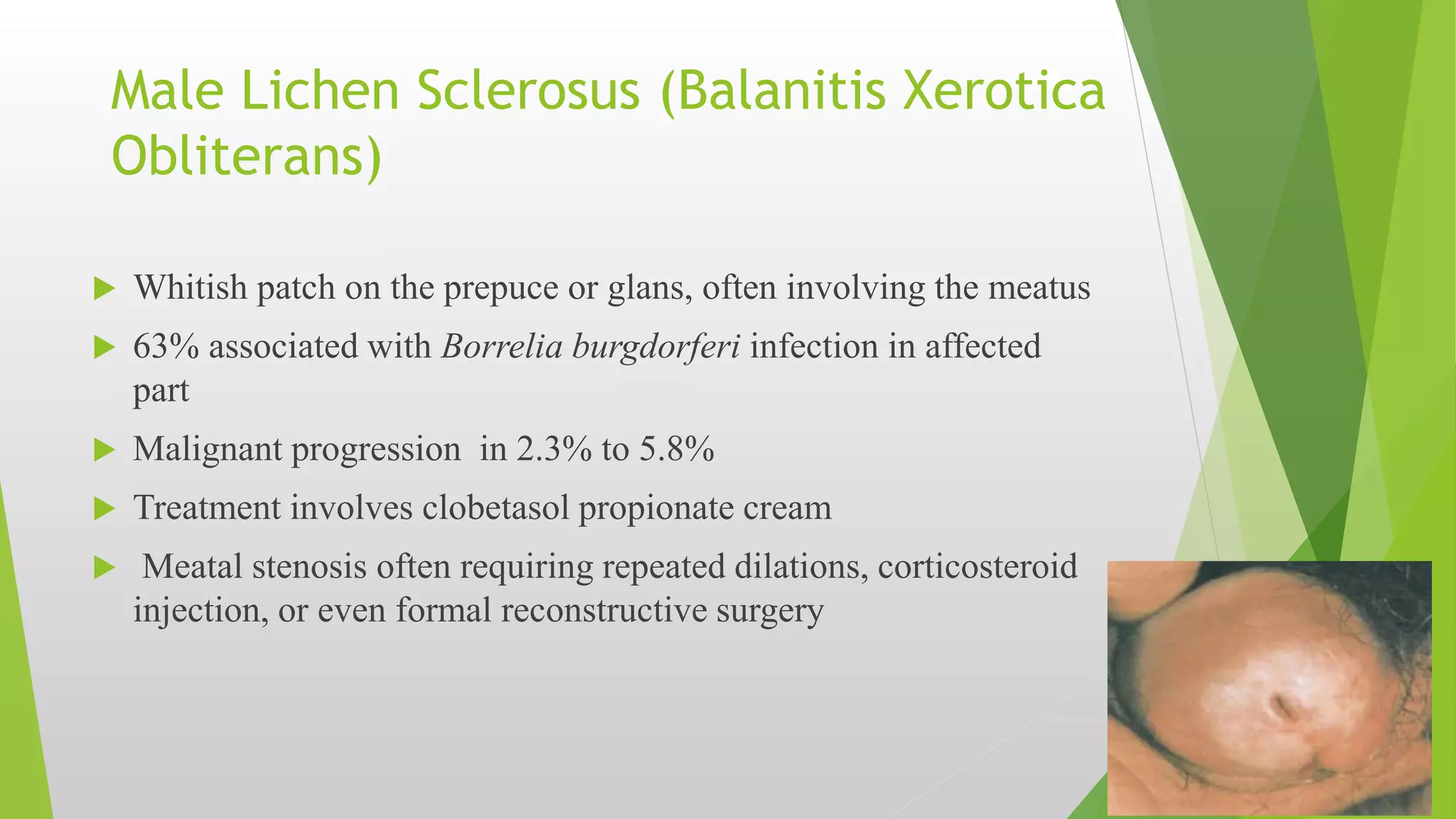 ETIOPATHOGENESIS AND STAGING OF CA PENIS (1).pptx