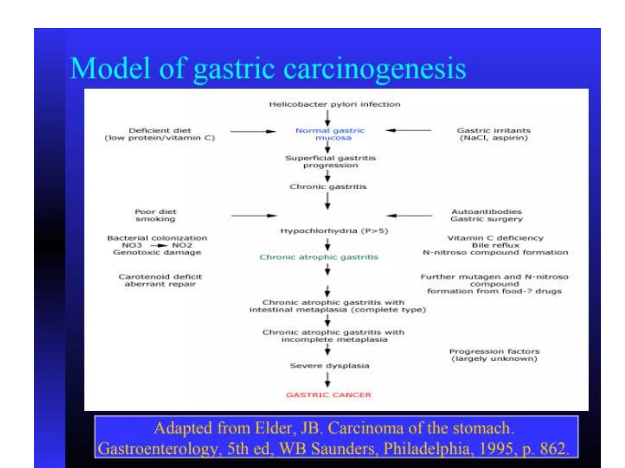 Etiopathogenesis and staging of gastric cancer | PPTX