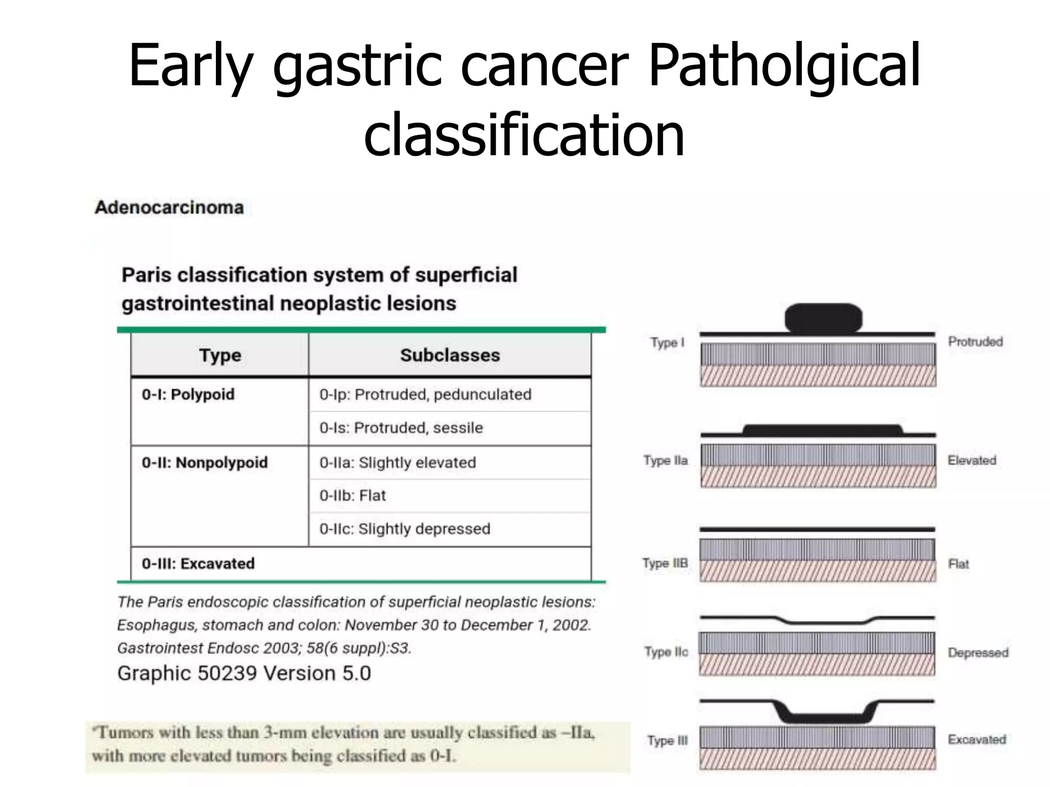 Etiopathogenesis and staging of gastric cancer | PPTX