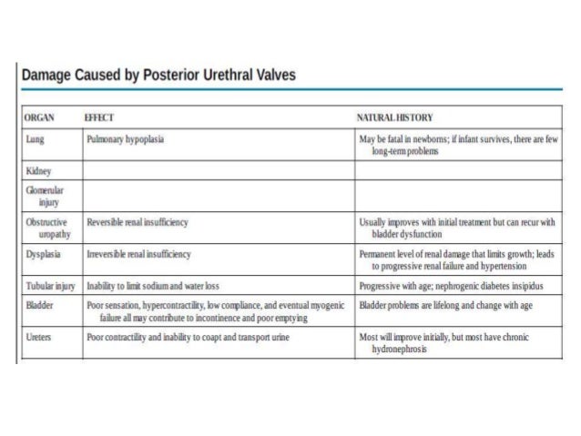 Posterior Urethral Valve Types - Design Talk
