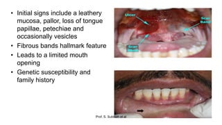 ETIOPATHOGENESIS OF HEAD AND NECK CANCER.pptx