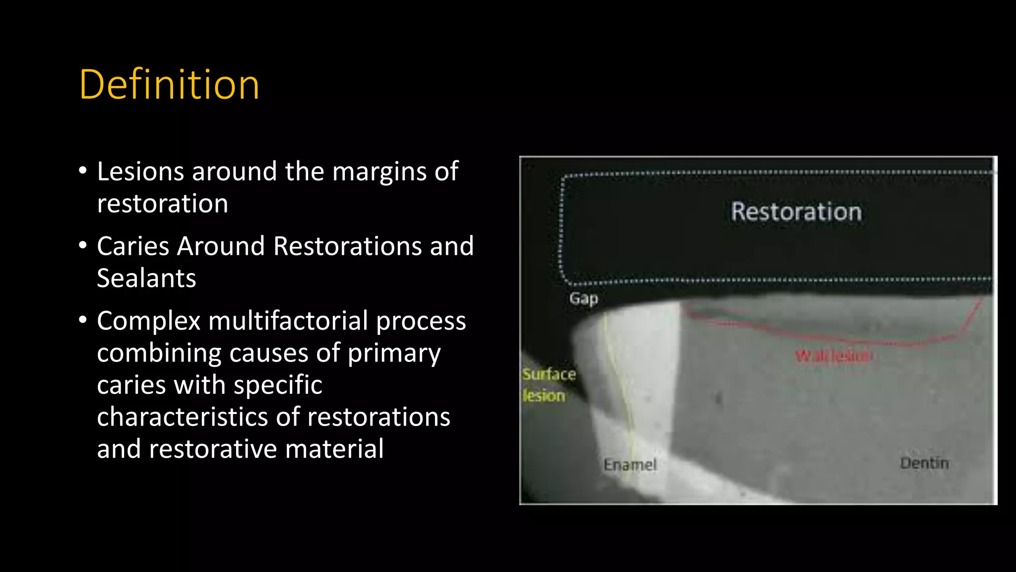 Secondary Caries Overview And Management Pdf