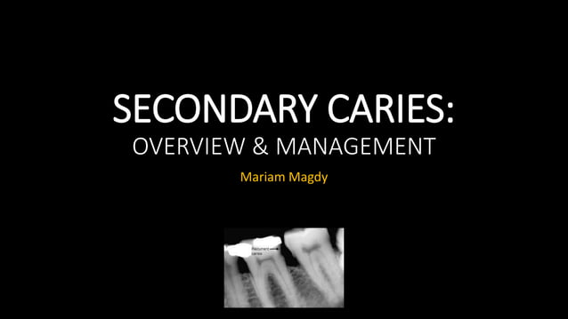 Secondary Caries Overview And Management Pdf