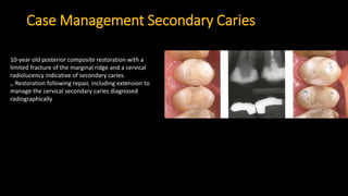 SECONDARY_CARIES_OVERVIEW_AND_MANAGEMENT.pdf