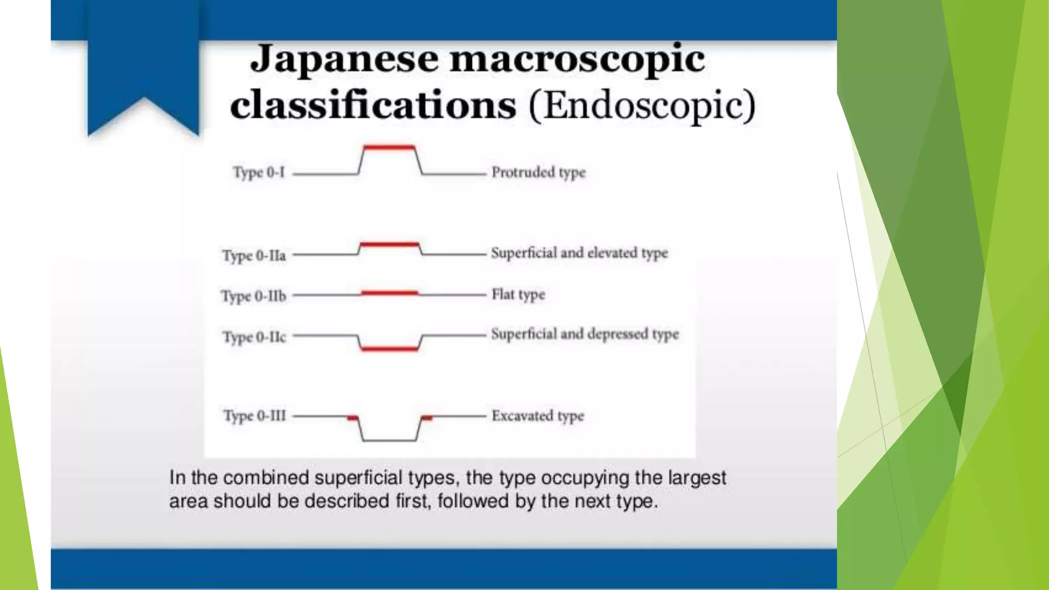 CARCINOMA STOMACH AETIOLOGY,CLASSIFICATION & CLINICAL FEATURES BY JOSE ...
