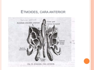 Etmoides | PPTX