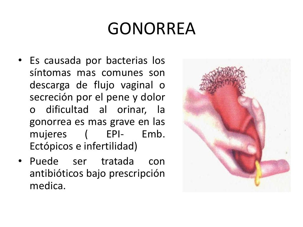 Enfermedades De Transmision Sexual Enfermedades Vener