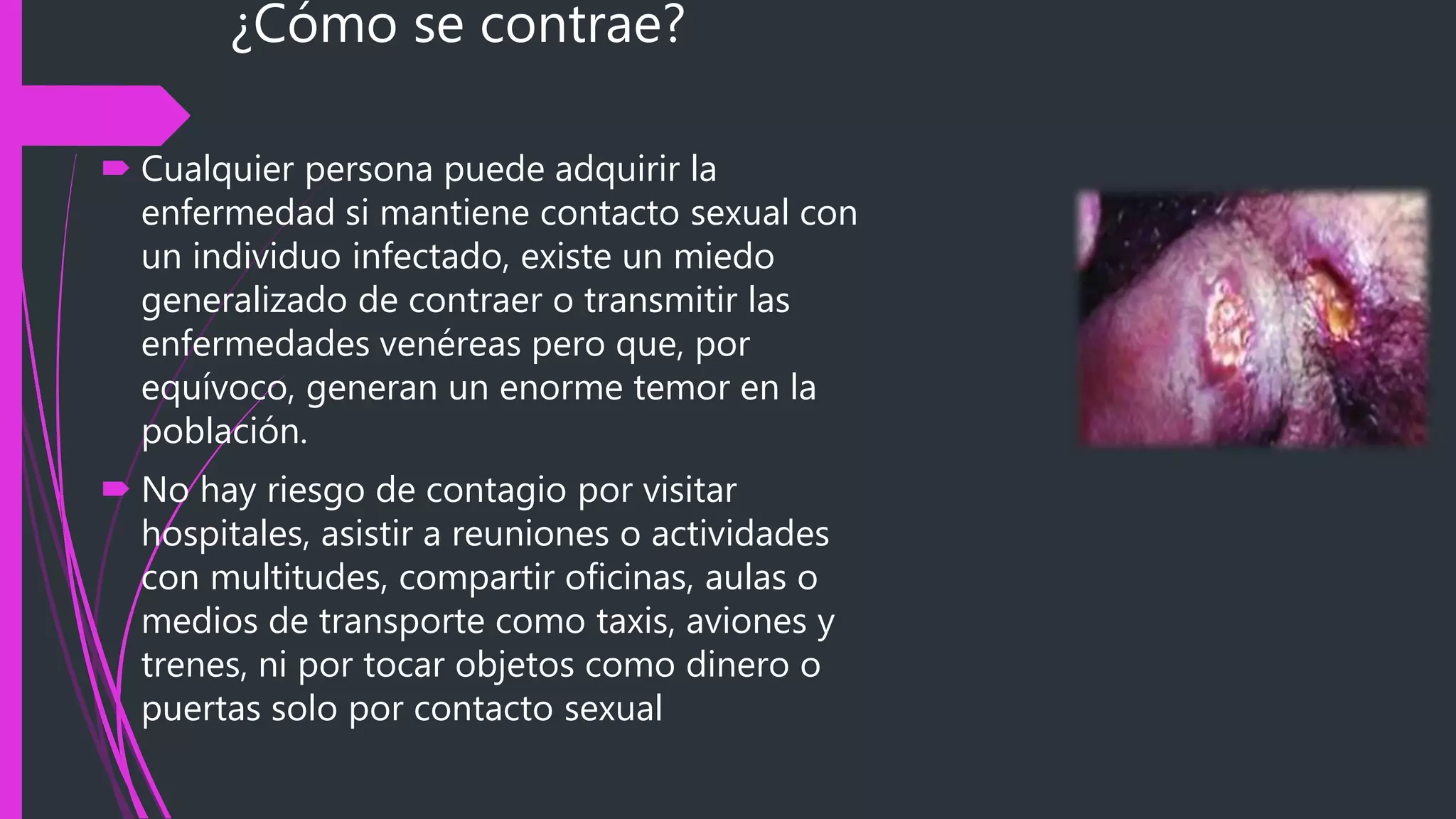 Ets chancro o chancroide | PPTX