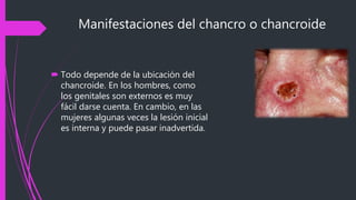 Ets chancro o chancroide | PPTX