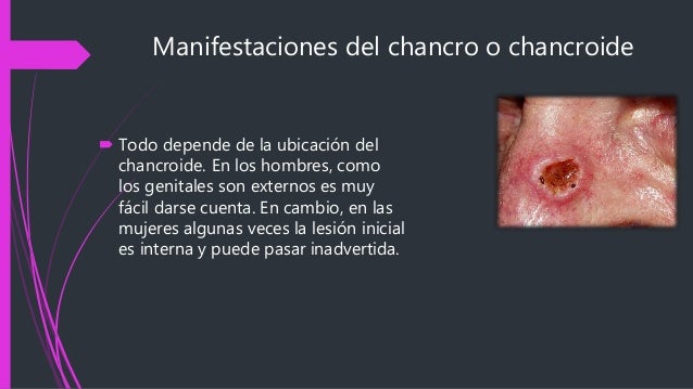 Ets chancro o chancroide