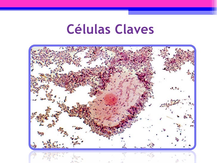 Ets, leucorreas y epi