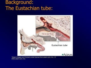 Eustachian Tube Stent | PDF | Ear, Nose and Throat Conditions ...