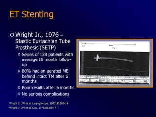 Eustachian Tube Stent | PDF | Ear, Nose and Throat Conditions ...