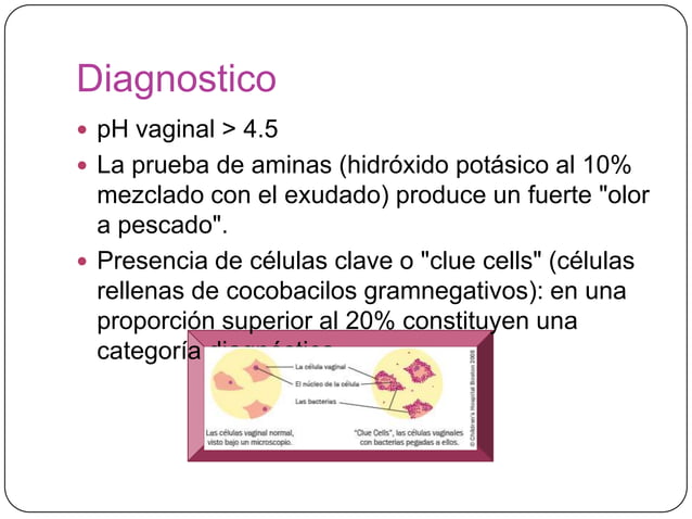 Ets Vulvovaginitis Uretritis Y Cervicitis Ppt