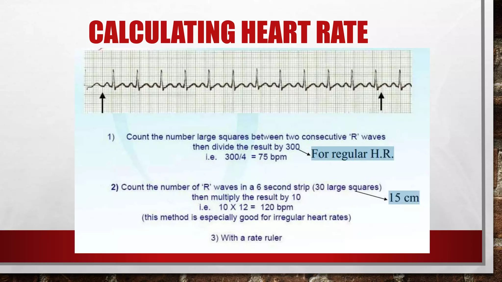EET (Exercise Tolerance Test ) | PPTX